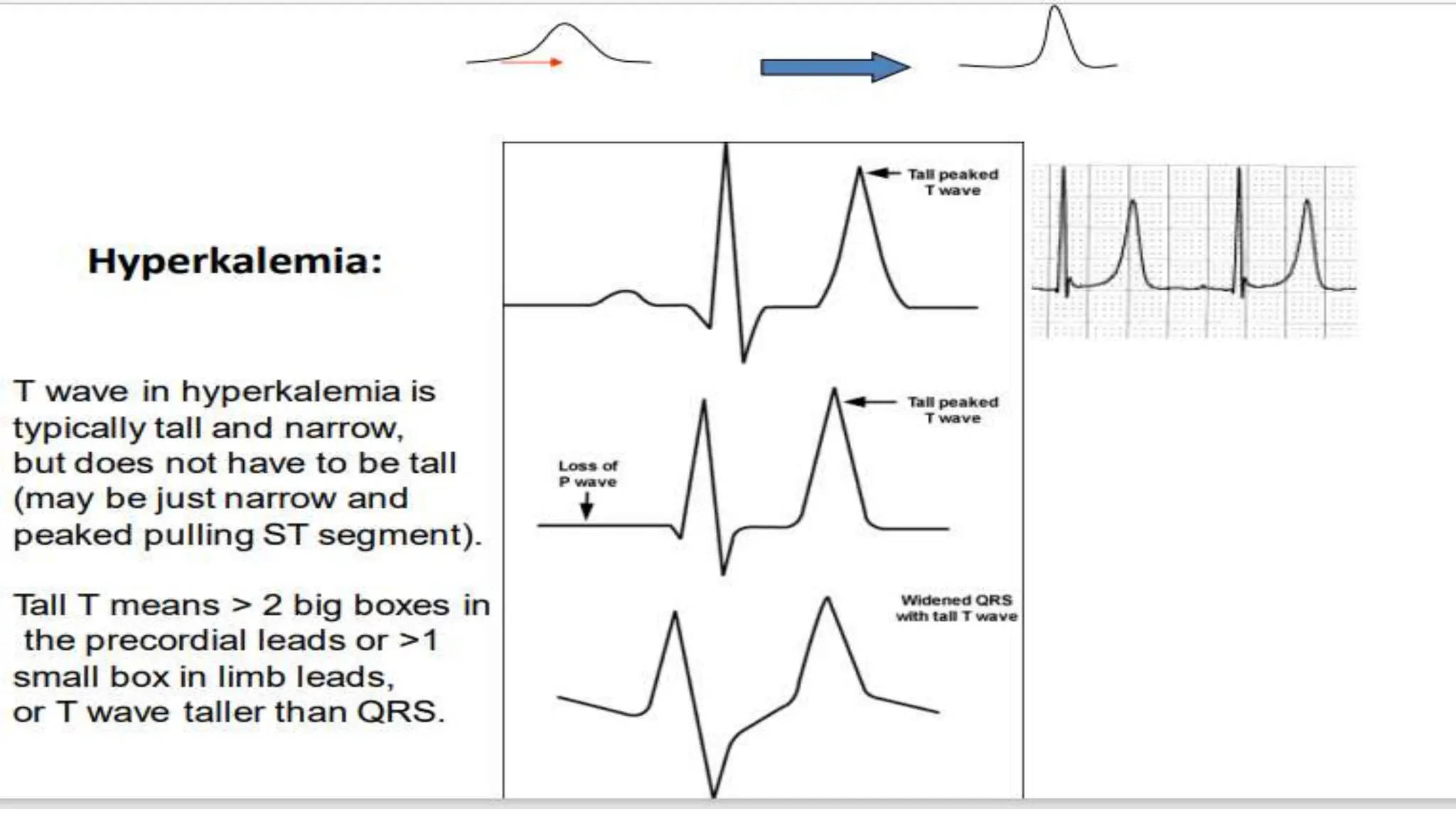 ECG basics simplified for students .pptx