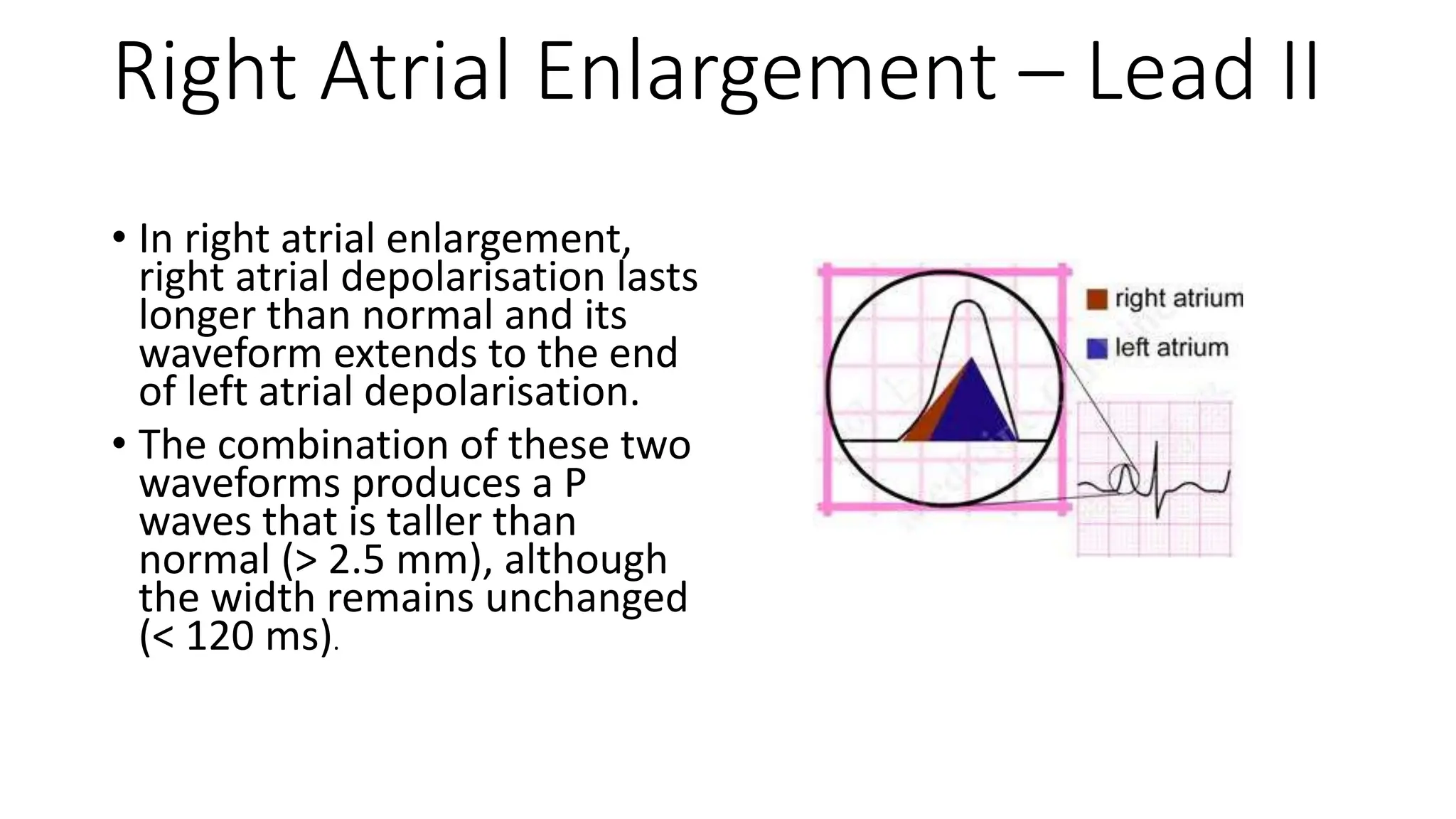 ECG basics simplified for students .pptx