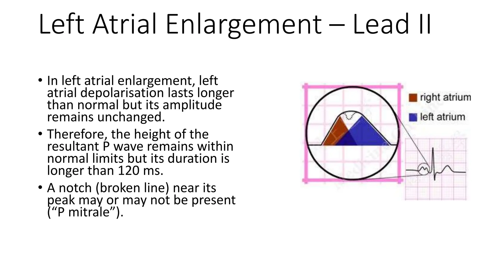 ECG basics simplified for students .pptx