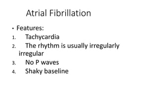 ECG basics simplified for students .pptx