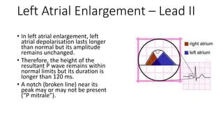 ECG basics simplified for students .pptx