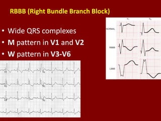 Ecg 2019 b | PPT