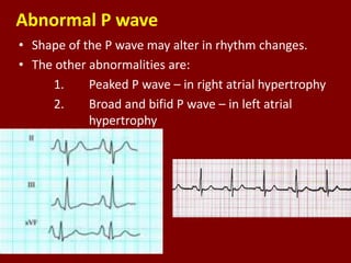 Ecg 2019 b | PPT