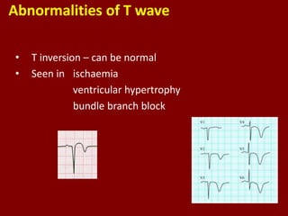 Ecg 2019 b | PPT