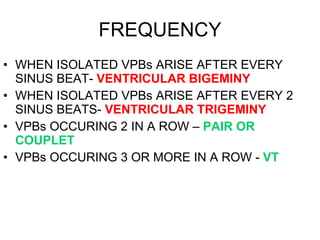 ECG: Ventricular Premature Beats | PPT