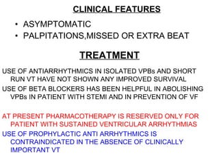 ECG: Ventricular Premature Beats | PPT