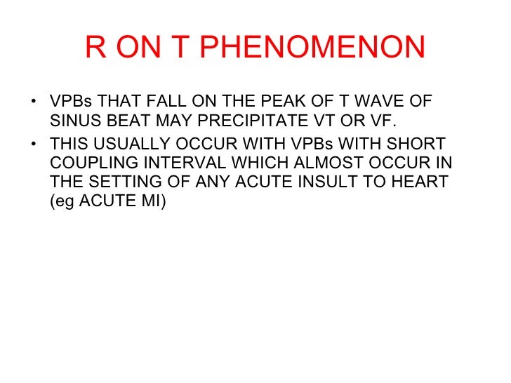 ECG: Ventricular Premature Beats