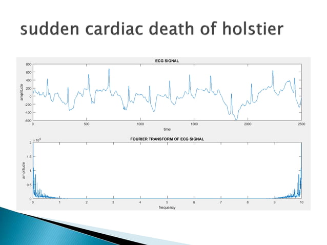 ECG SIGNAL GENERATED FROM DATA BASE USING MATLAB | PPTX | Heart and Cardiovascular Diseases ...