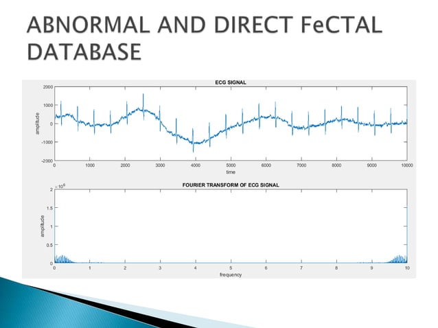 ECG SIGNAL GENERATED FROM DATA BASE USING MATLAB | PPTX | Heart and ...