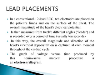 ECG SIGNAL GENERATED FROM DATA BASE USING MATLAB | PPTX | Heart and ...