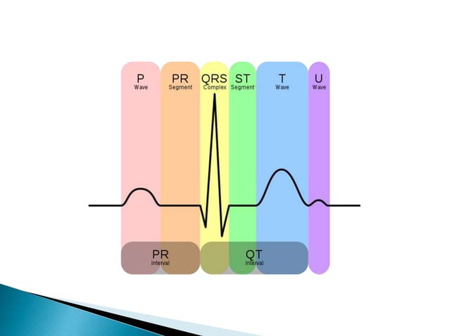 ECG SIGNAL GENERATED FROM DATA BASE USING MATLAB | PPTX | Heart and ...