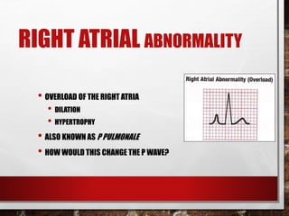 ECG3.ppt