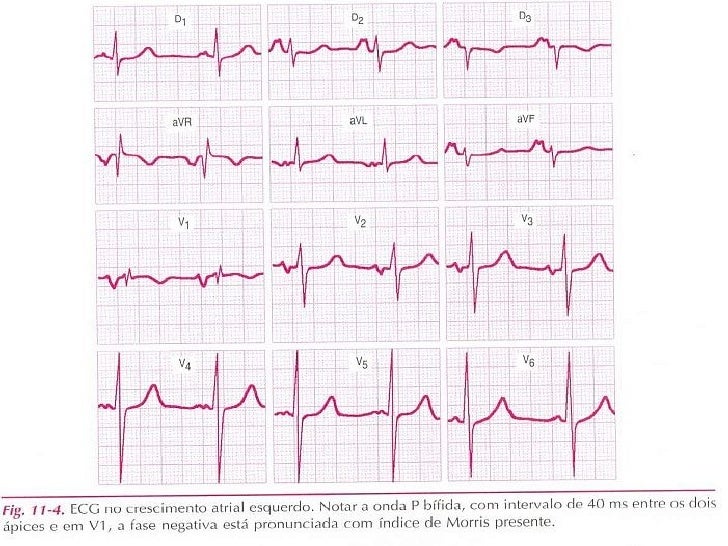 Ecg 4.0