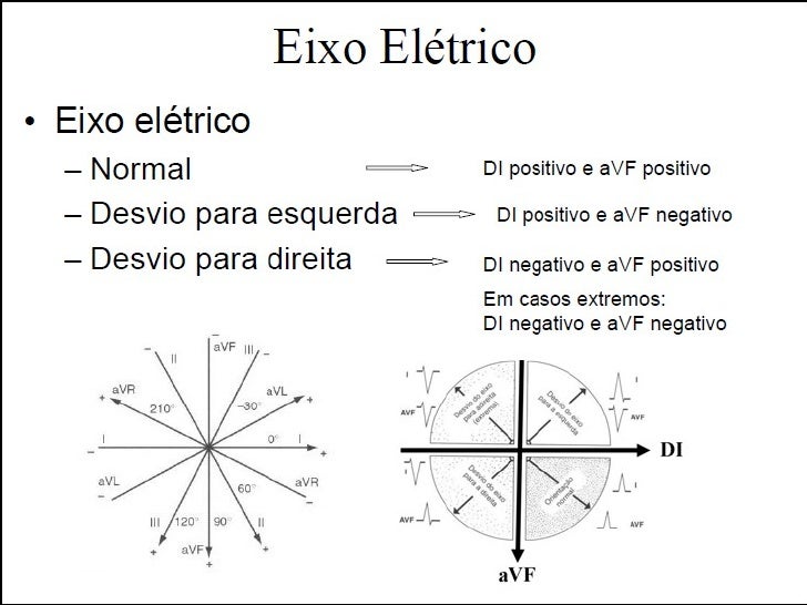 Ecg 4.0