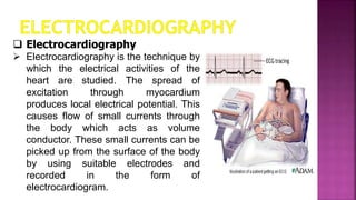 ECG | PPT