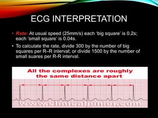 Ecg 5th year 2016 | PPTX