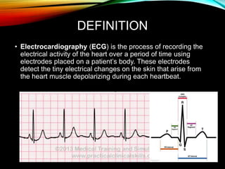 Ecg 5th year 2016 | PPTX
