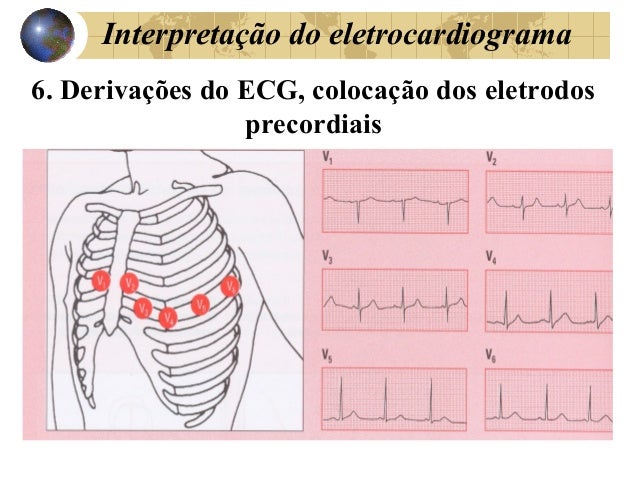 Ecg 86 slides