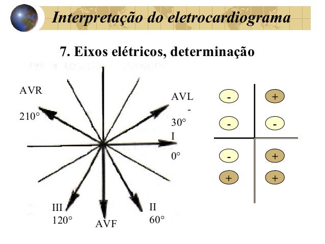Ecg 86 slides