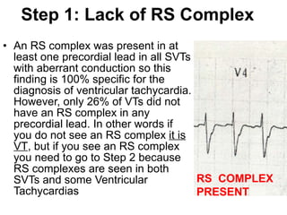 ECG: Fascicular VT | PPT