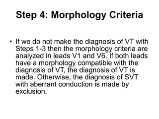 ECG: Fascicular VT | PPT