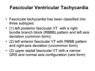 ECG: Fascicular VT | PPT
