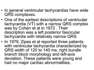 ECG: Fascicular VT | PPT