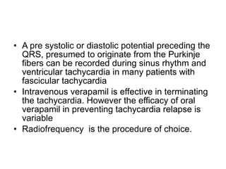 ECG: Fascicular VT | PPT