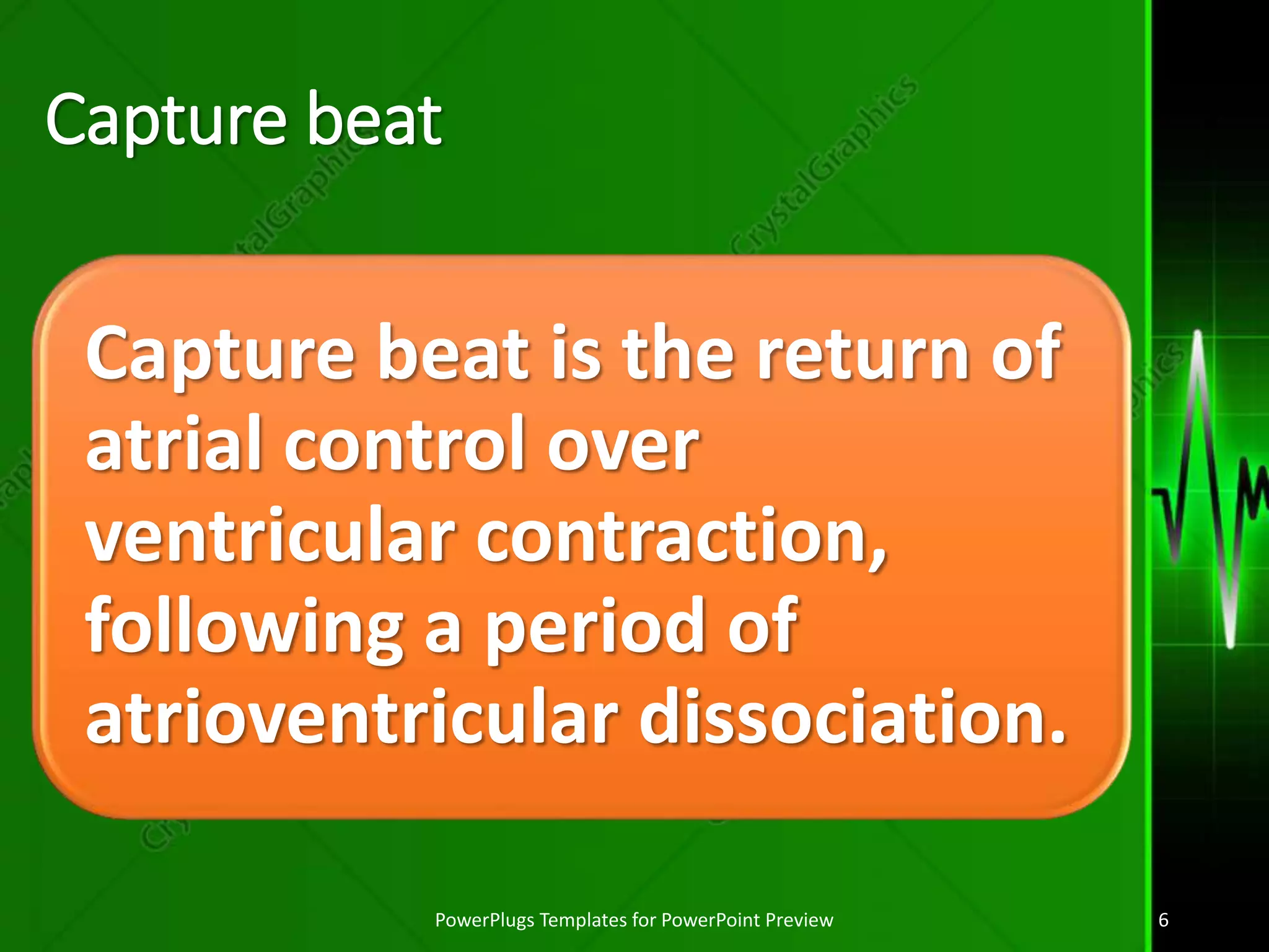 ECG A: first part. | PPSX