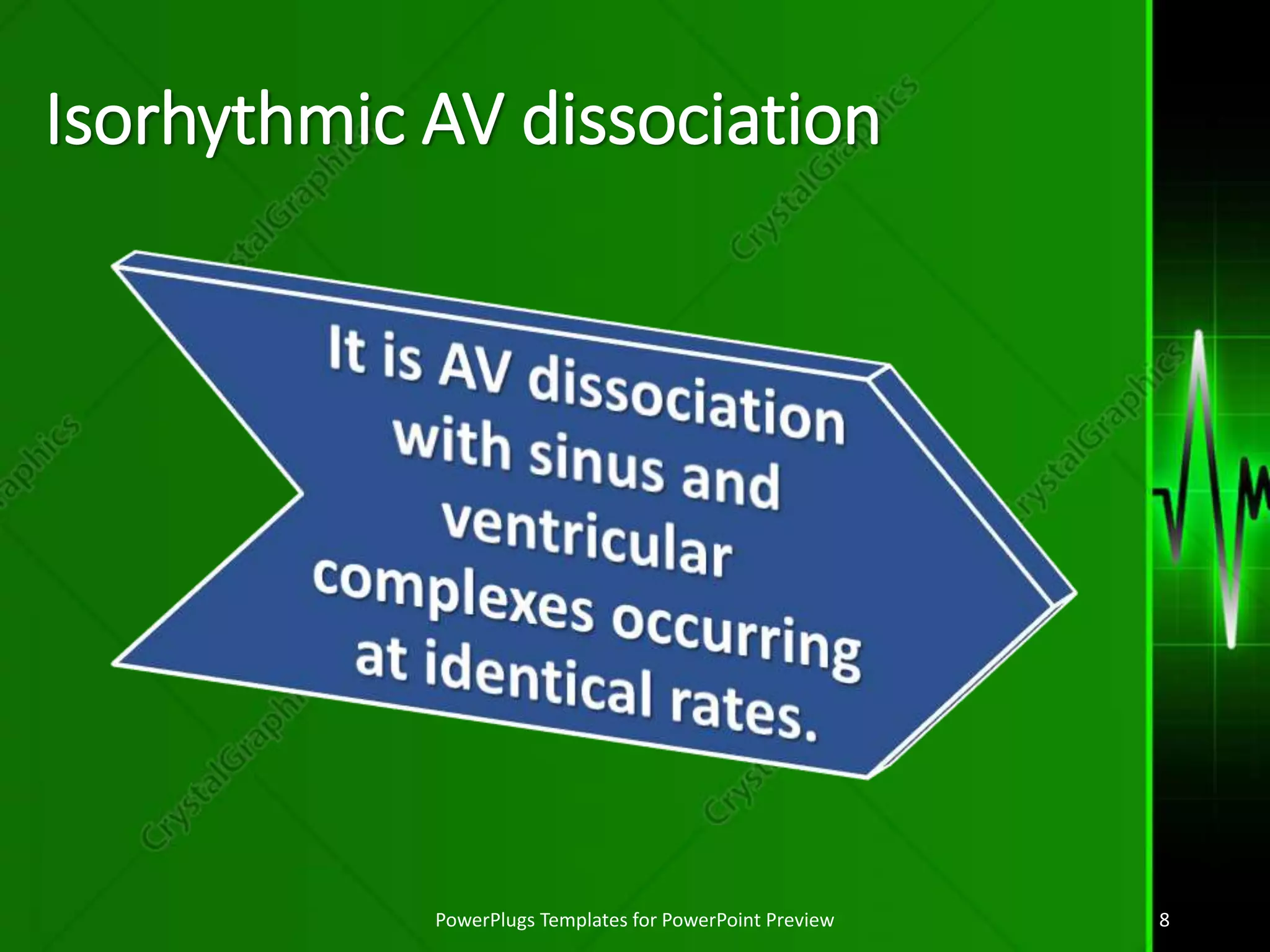 ECG A: first part. | PPSX