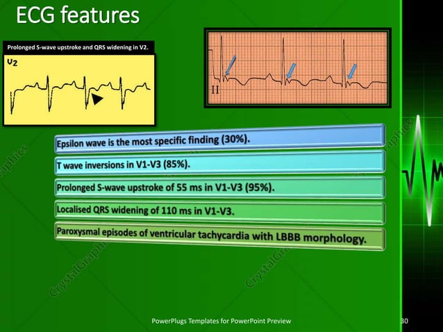ECG A: first part. | PPT