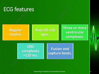 ECG A: first part. | PPSX