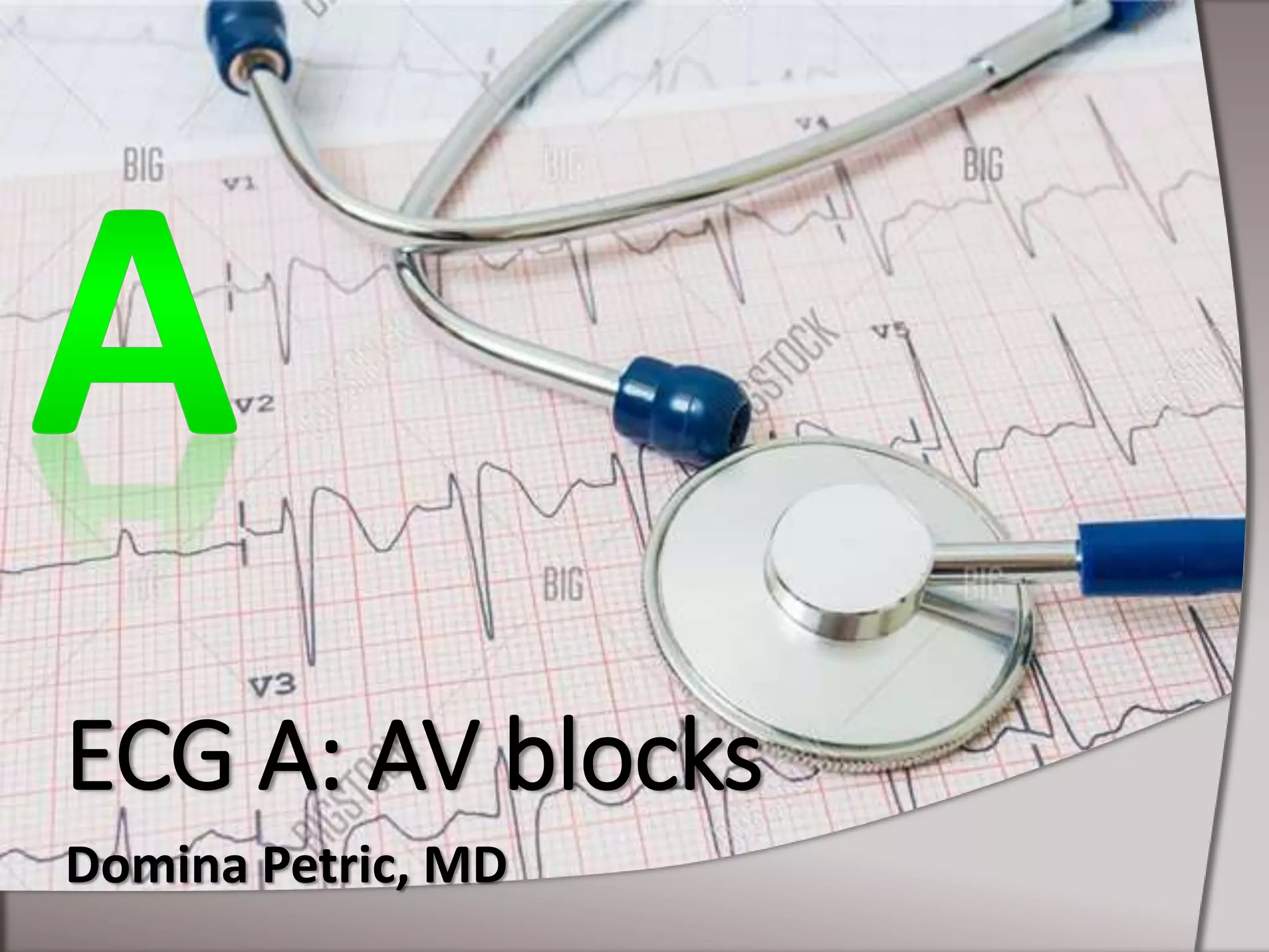 ECG A: AV blocks | PPSX