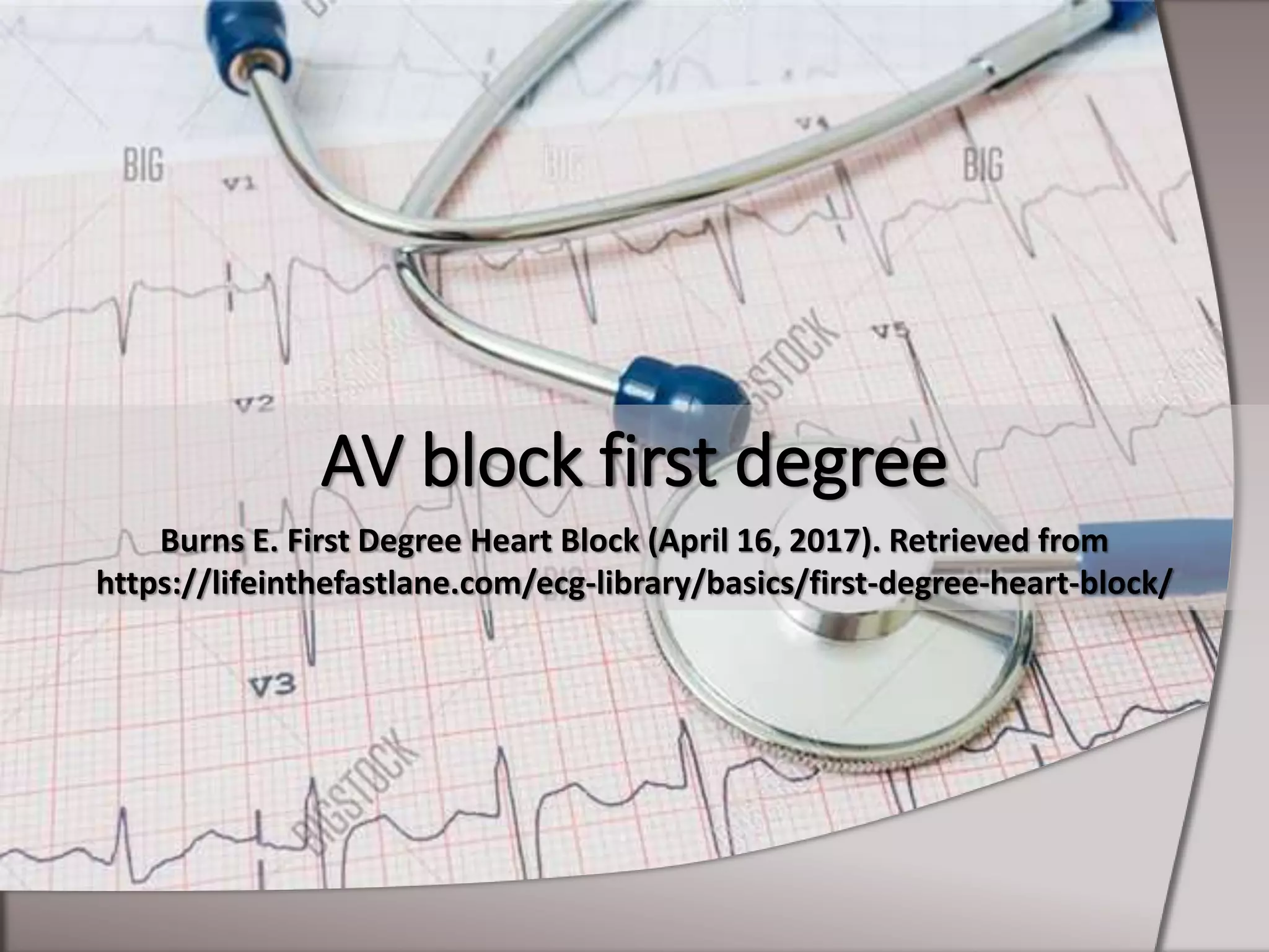 ECG A: AV blocks | PPSX