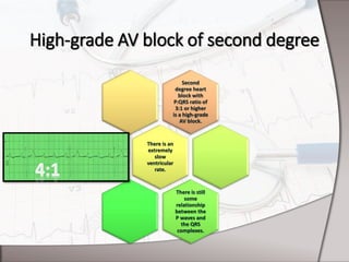 ECG A: AV blocks | PPSX | Heart and Cardiovascular Diseases | Diseases ...