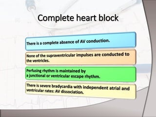 ECG A: AV blocks | PPSX