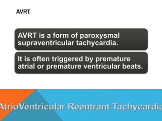 ECG A: AVNRT, AVRT | PPSX