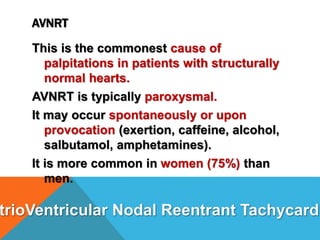 ECG A: AVNRT, AVRT | PPSX