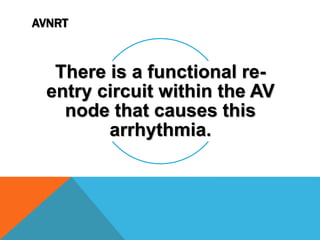 ECG A: AVNRT, AVRT | PPSX
