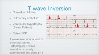 ECG Abnormalities in Pulmonary Medicine | PPTX