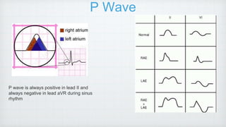 ECG Abnormalities in Pulmonary Medicine | PPTX