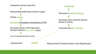 ECG principles Acute coronary syndrome.pptx