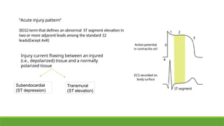 ECG principles Acute coronary syndrome.pptx
