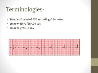 ECG AND ITS BASICS update (2020) By Dr Rahul Jain & Dr Sharda Jain | PPTX