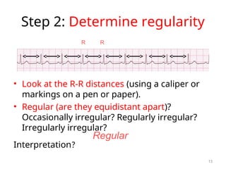 nursing cardiology ECG AND DYSRHYTHMIAS.ppt