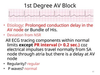 nursing cardiology ECG AND DYSRHYTHMIAS.ppt