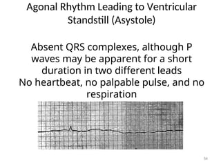 nursing cardiology ECG AND DYSRHYTHMIAS.ppt