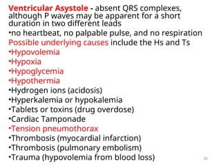nursing cardiology ECG AND DYSRHYTHMIAS.ppt