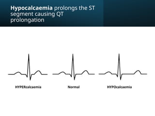 ECG and electrolyte imbalance and interpretation | PPTX