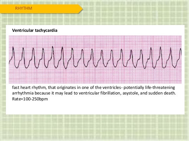 Lethal Heart Rhythms